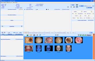 ClearStone data base